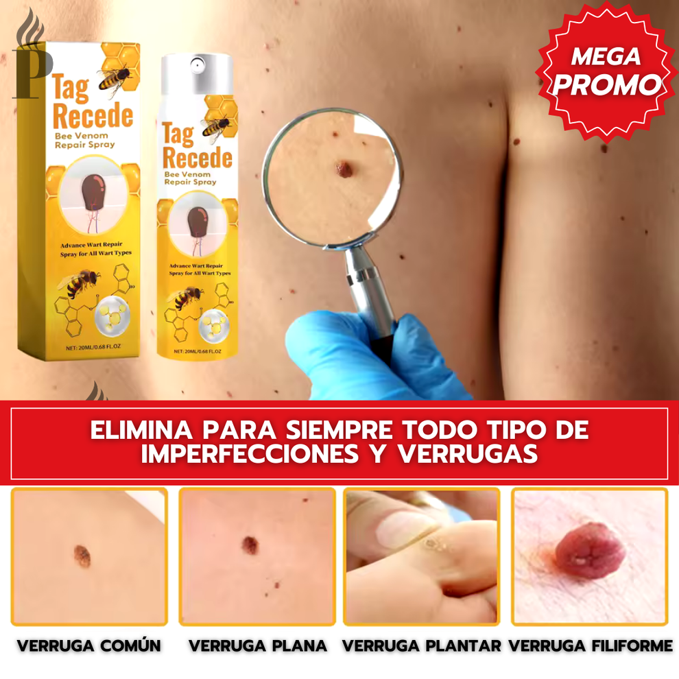 Tag Recede™: Spray Eliminador de Verrugas Instantáneo – #1 en Ventas